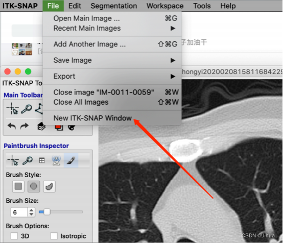 【ITK 基本操作说明】_itk教程-CSDN博客
