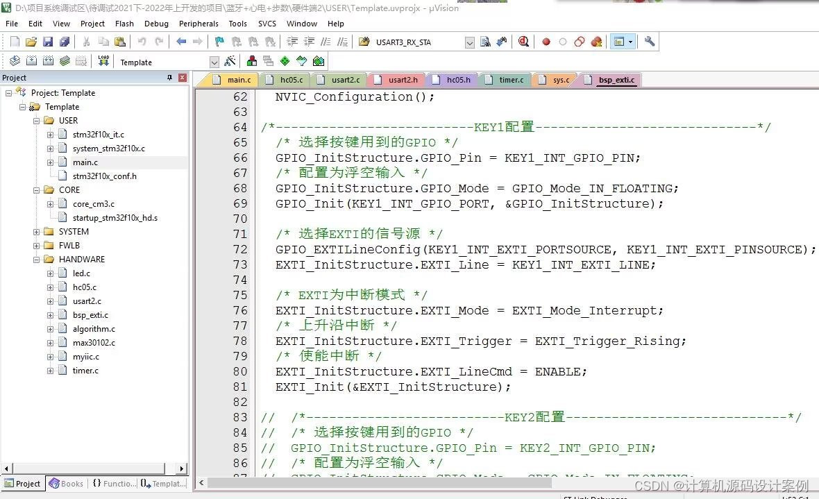 基于stm32单片机心率脉搏监测健康运动计步系统设计 单片机毕业源码设计基于stm32单片机的心率脉搏监测健康运动记步系统设计综述 Csdn博客