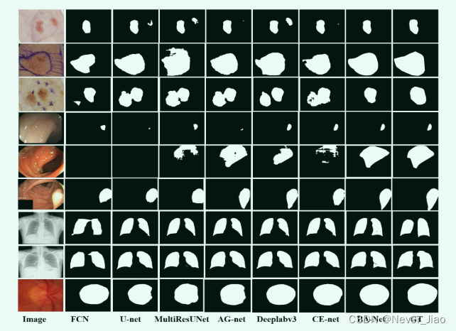 Boundary-aware Context Neural Network for Medical Image Segmentation-CSDN博客