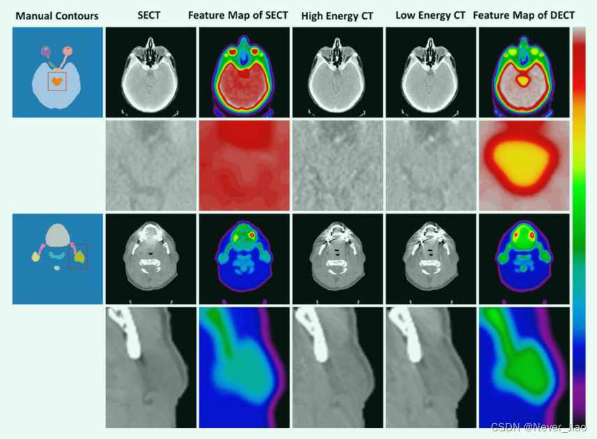 Head and neck multi-organ segmentation on dual-energy CT using dual ...