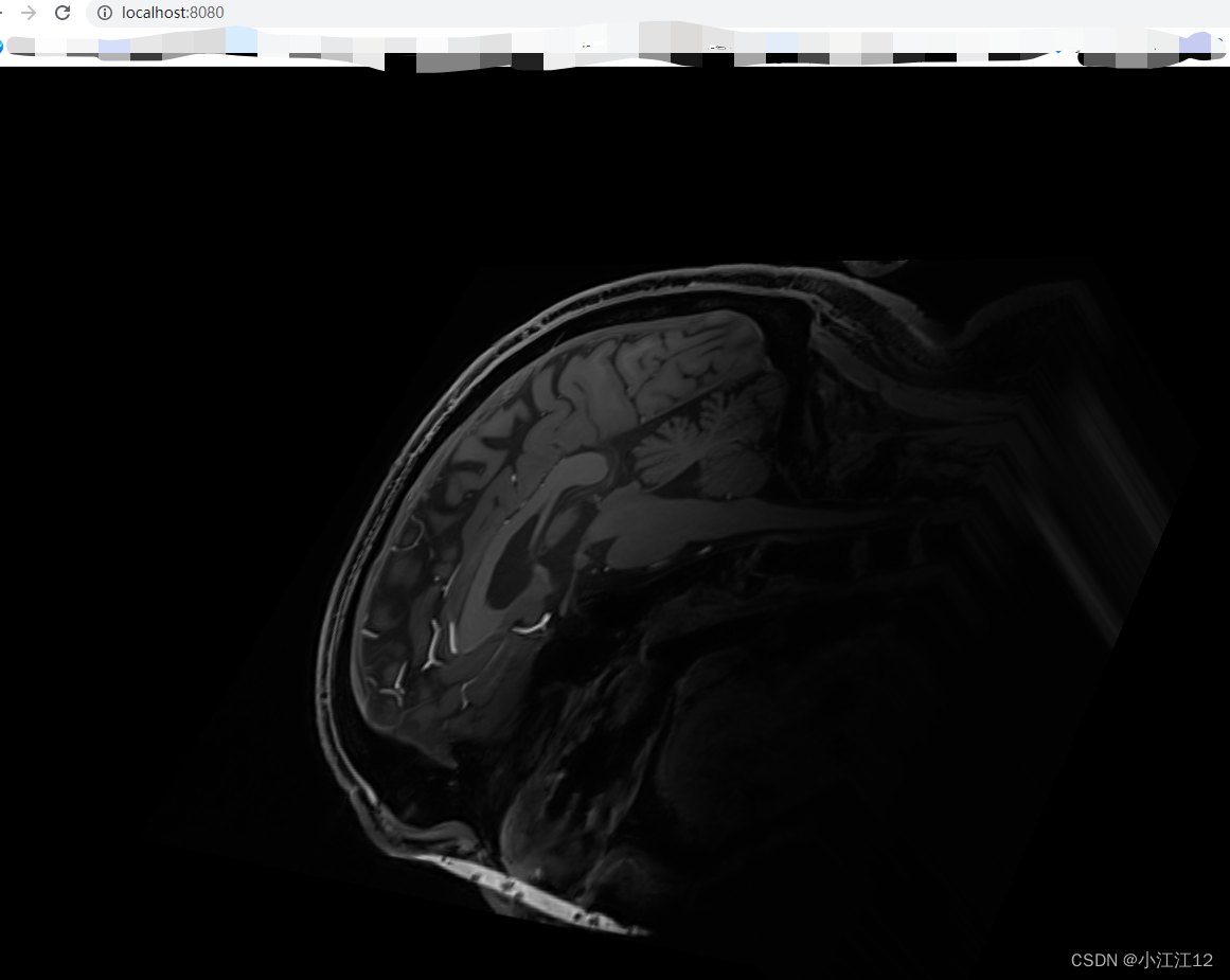 itk.js读取dicom文件，vtk.js进行渲染_itk.js vtk.js-CSDN博客