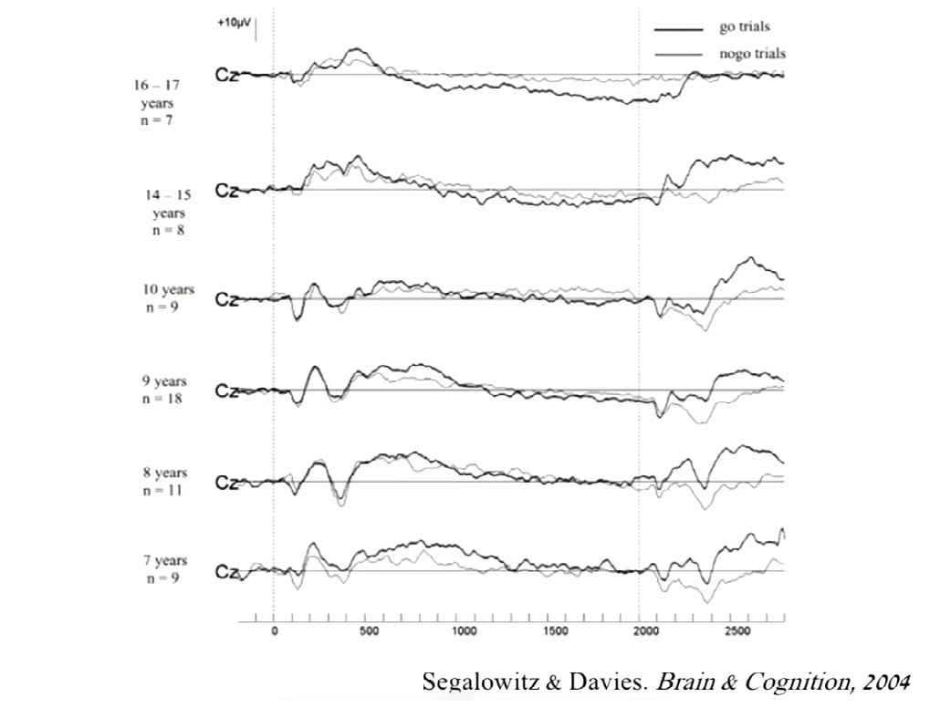 脑电实验设计的原理与实例-EEG Processing and Feature 4-CSDN博客