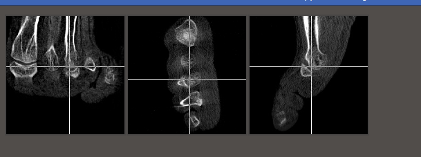 JS版生成MR模型-CSDN博客