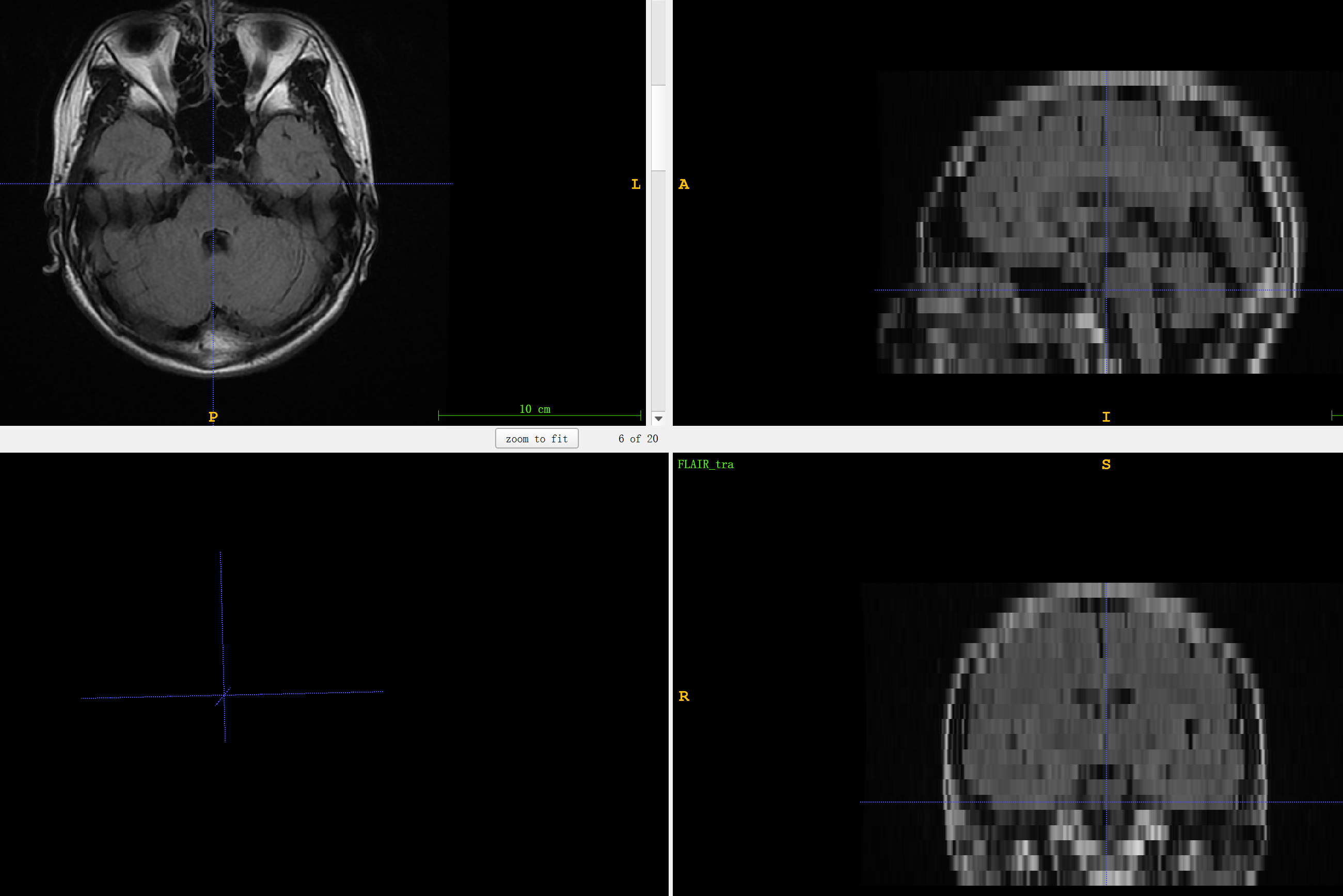 dicom转nii时，解决切片顺序保存混乱的问题_nii转 dicom后成不了序列-CSDN博客