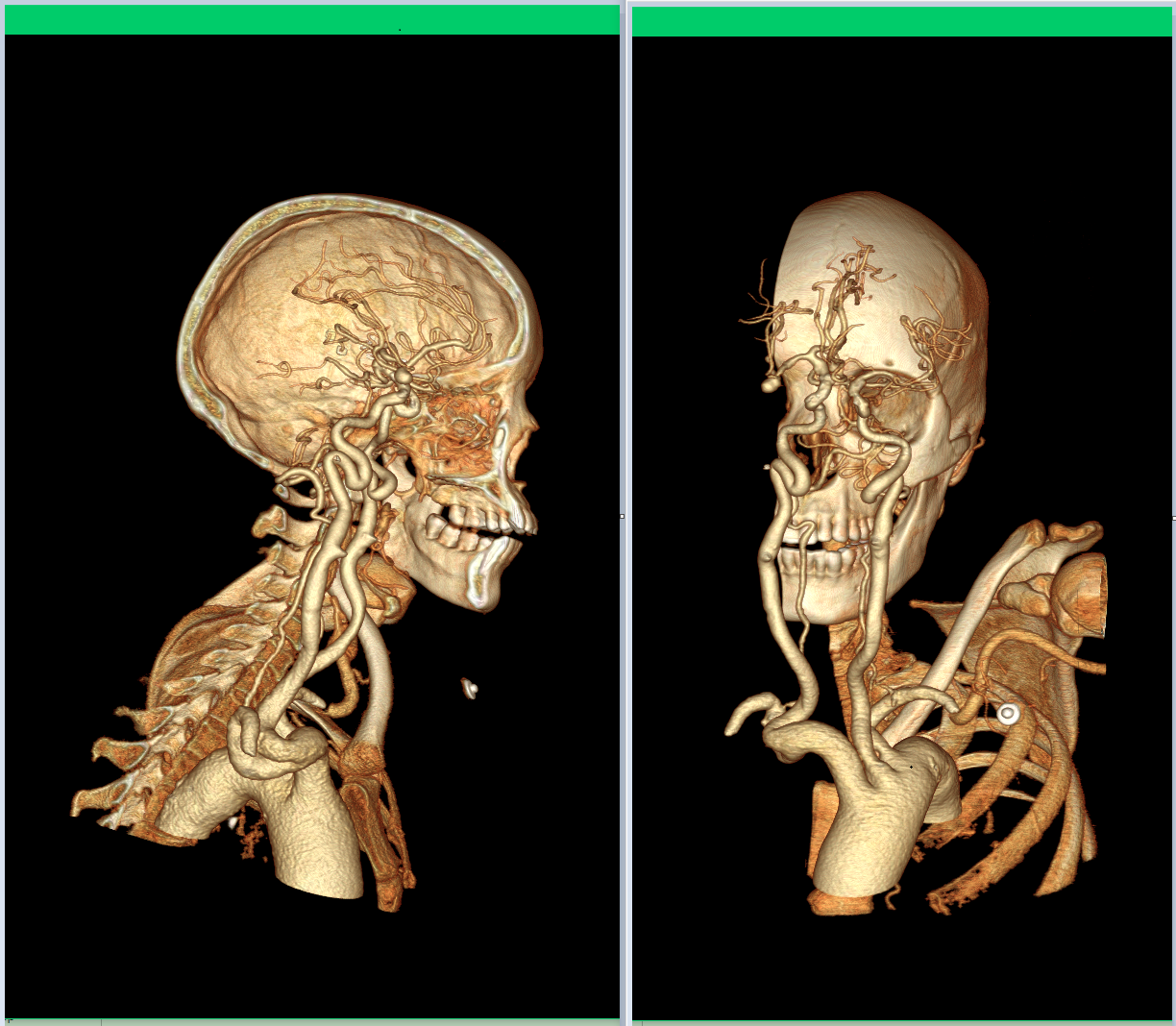 VTK实现多个体数据映射到一起进行渲染_vtkrenderer setposition-CSDN博客