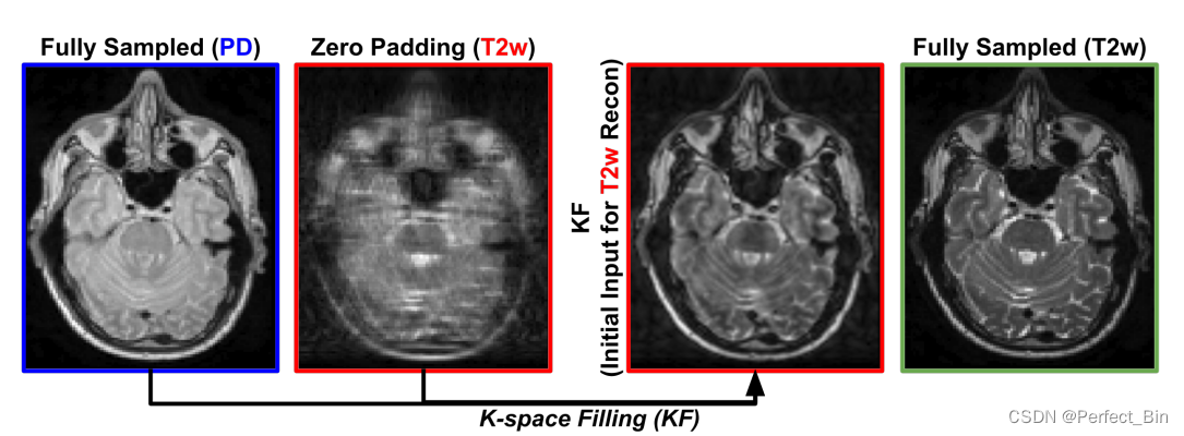 DSFormer: A Dual-domain Self-supervised Transformer for acc Multi-contrast MRI Re---文章阅读记录-CSDN博客
