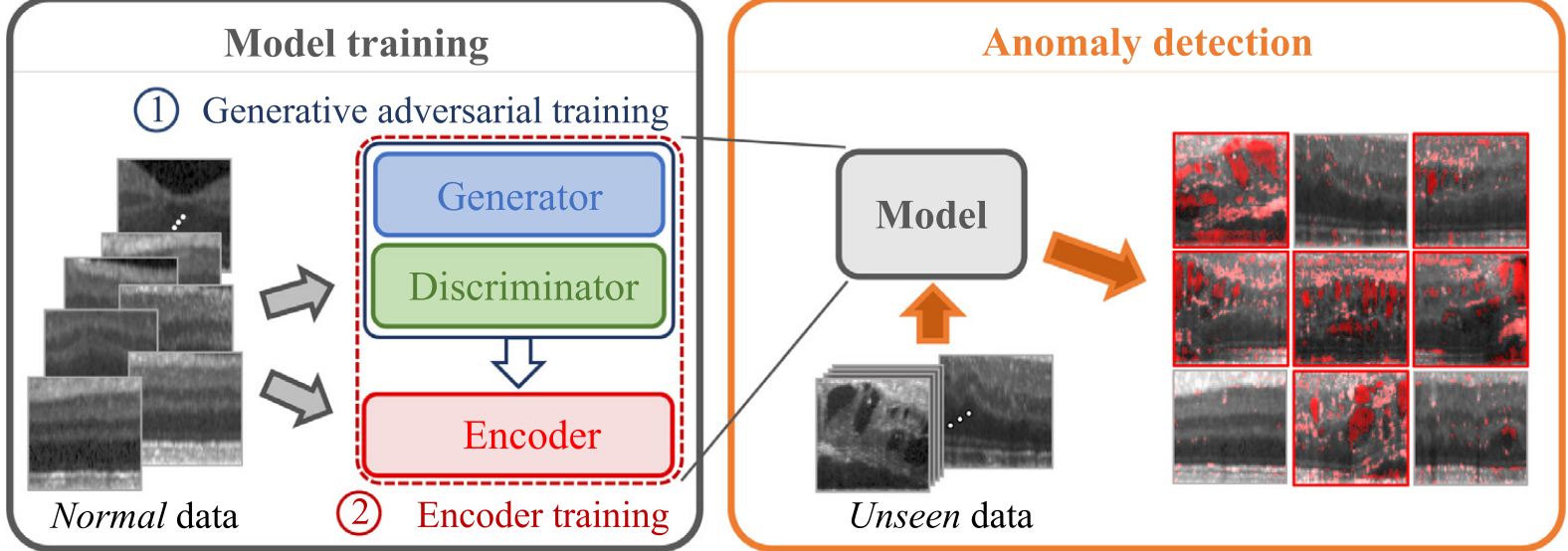 f-AnoGan阅读笔记-CSDN博客