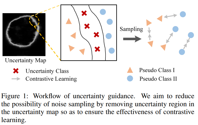 【IJCAI2022】Uncertainty-Guided Pixel Contrastive Learning for Semi-Supervised Medical Image ...