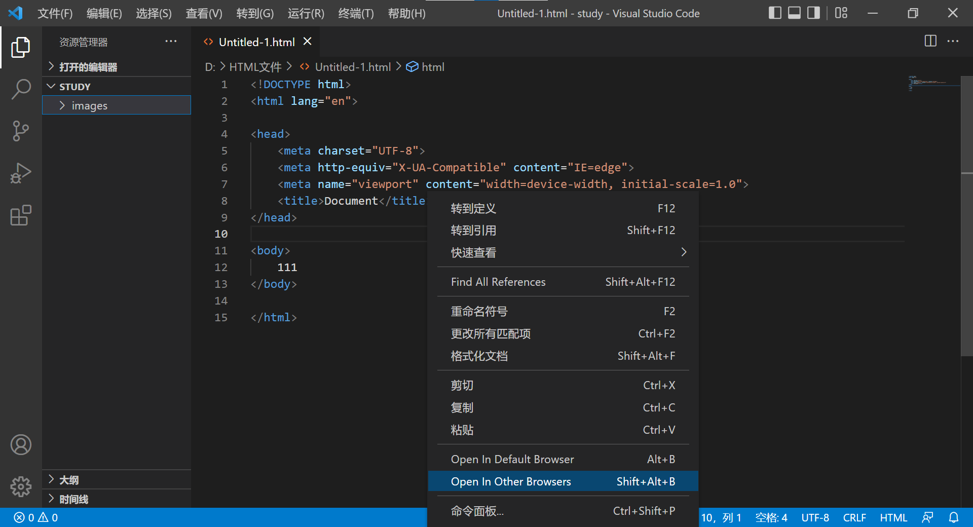 Visual Studio Code的下载与安装_visual studio code下载安装教程-CSDN博客