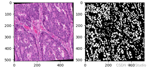 从无到有完成 Lizard 细胞分割_lizard数据集-CSDN博客