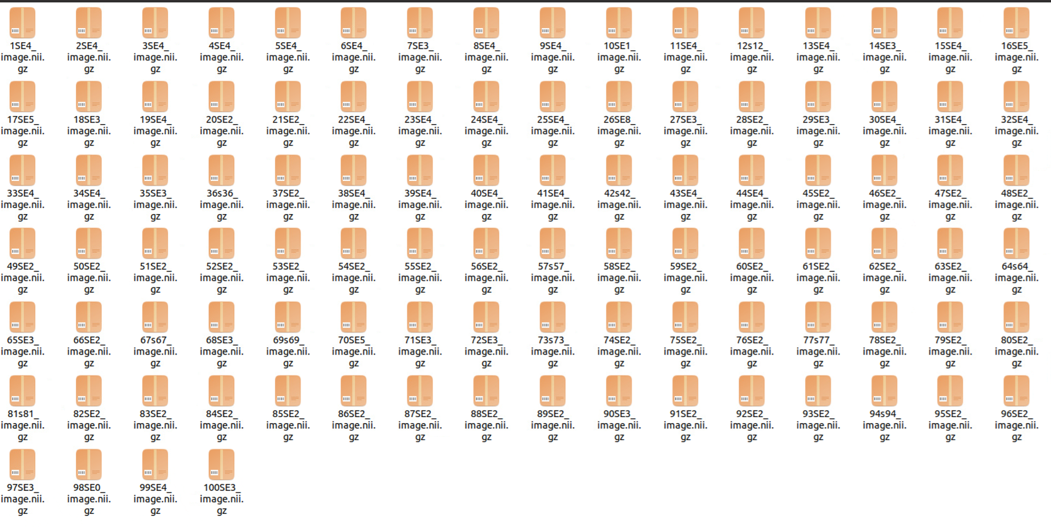 如何批量把影像数据dicom转化为niigzdicom 转 Niigz Csdn博客 