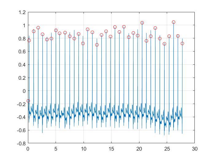 WFDB工具箱在Matlab2010b及更高版本上的安装_matlab wfdb-CSDN博客