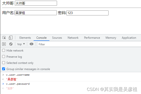 Vue的双向绑定vue常用登录双向绑定 Csdn博客
