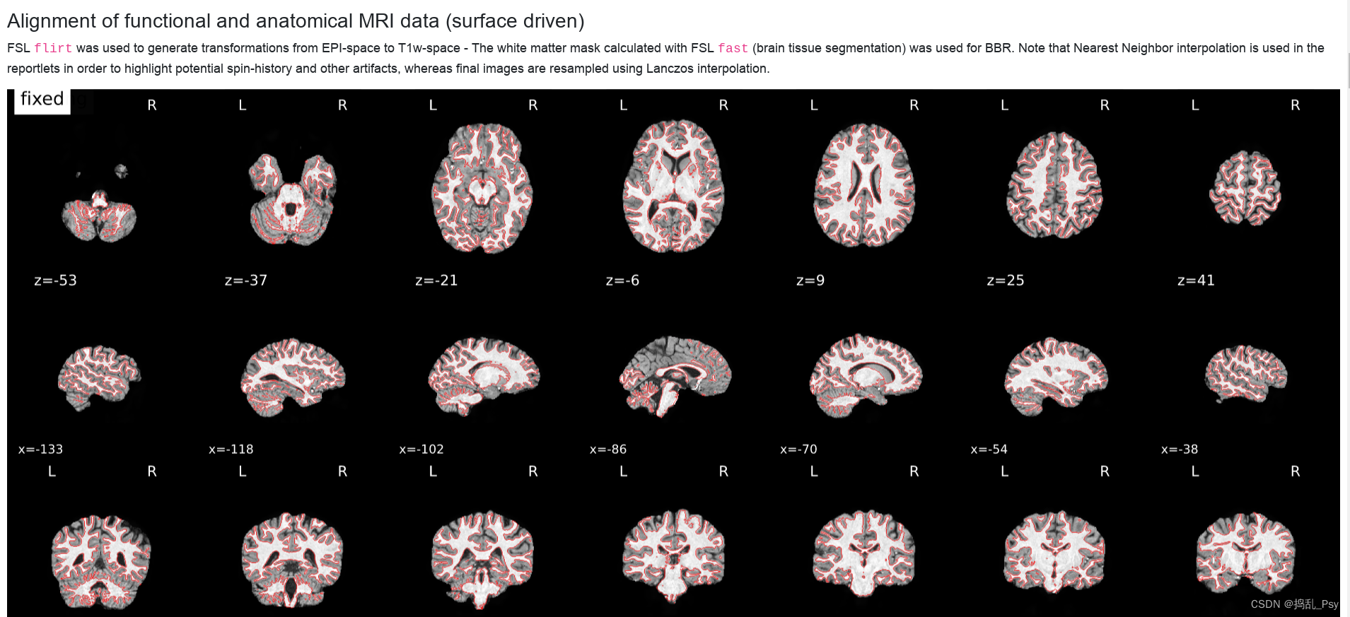 fMRI数据处理_预处理_3_批处理和结果解读_fmriprep-CSDN博客