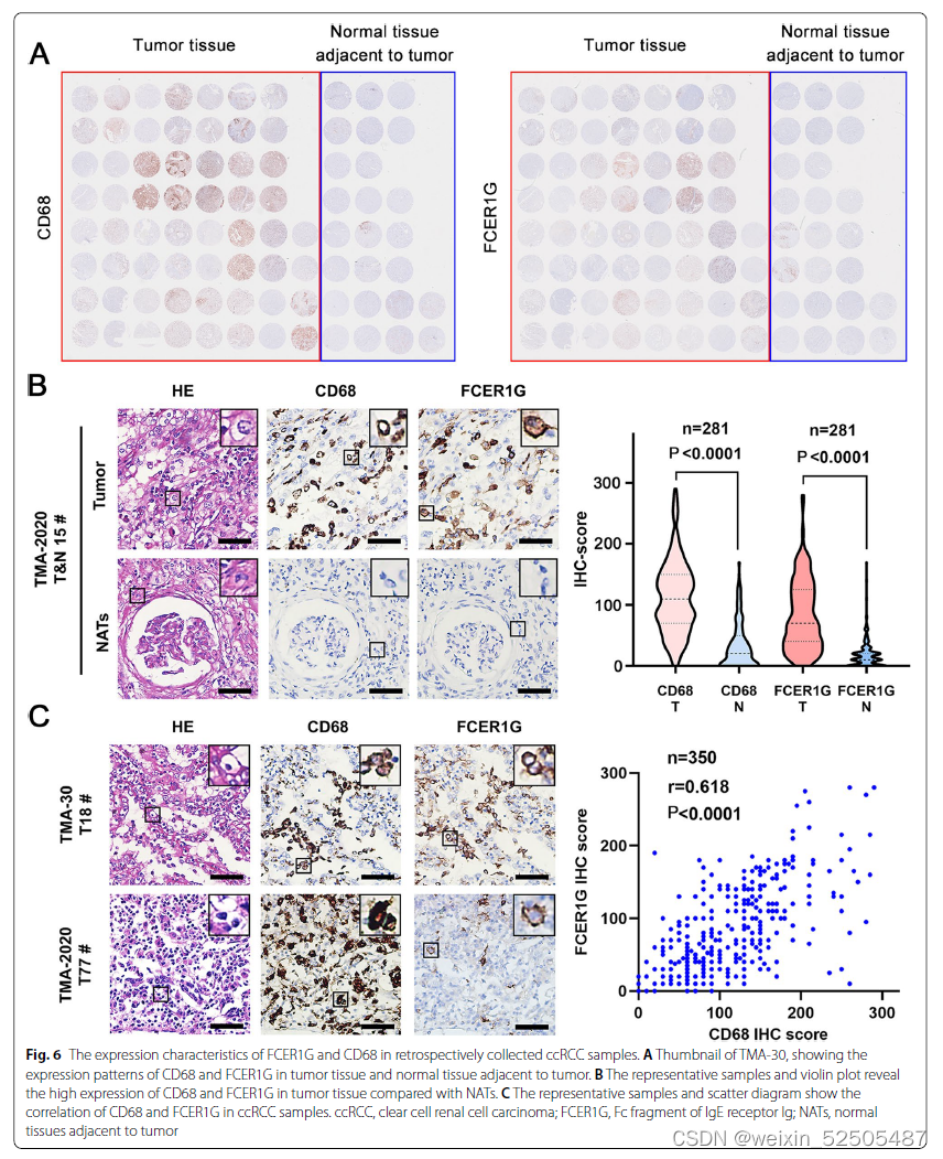 文献阅读-FCER1G与透明细胞癌中巨噬细胞的浸润相关并且通过调节肿瘤免疫产生不良预后-CSDN博客