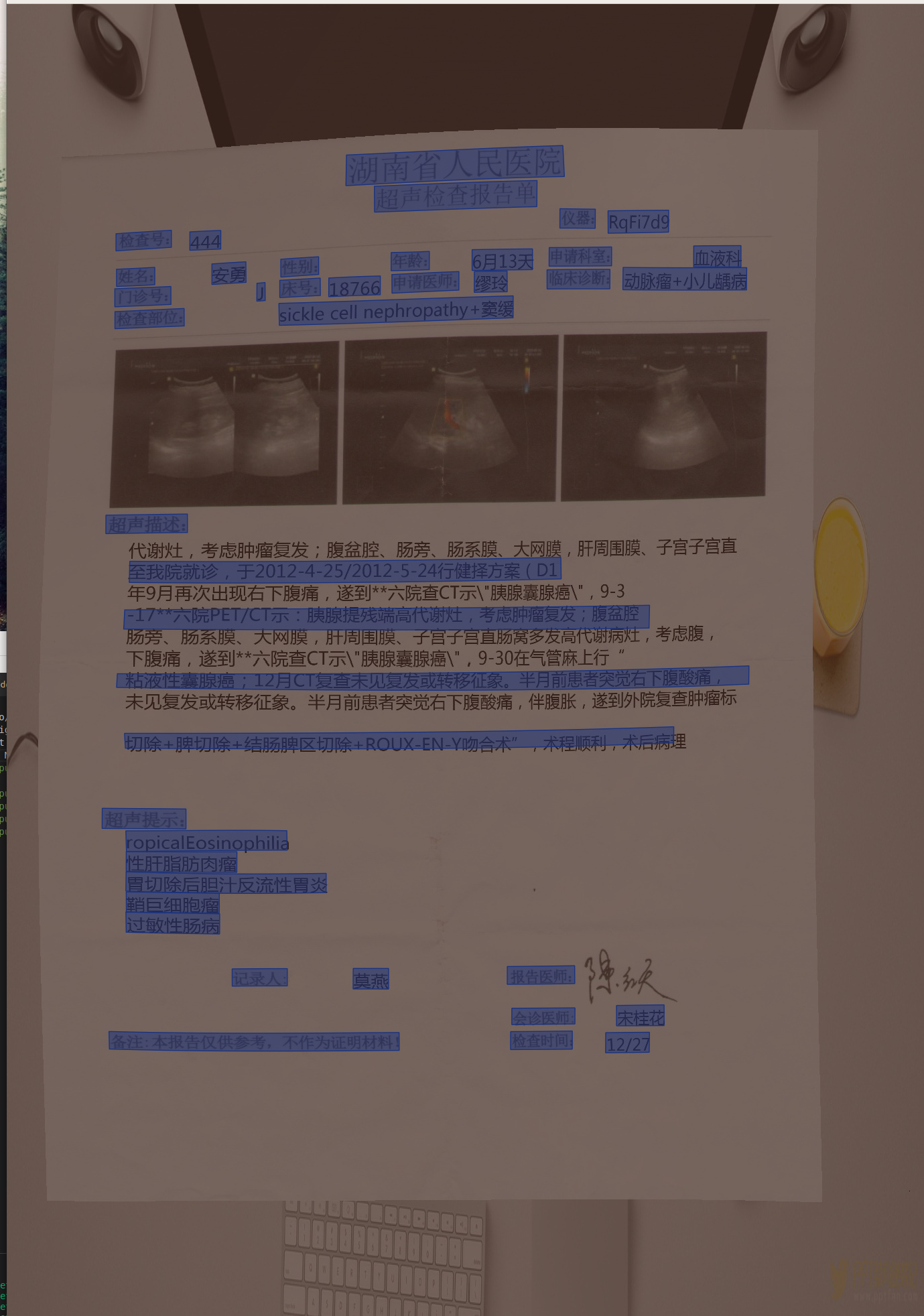 论文阅读:端到端文本检测和识别算法ABCNetv2+源码对应梳理-CSDN博客