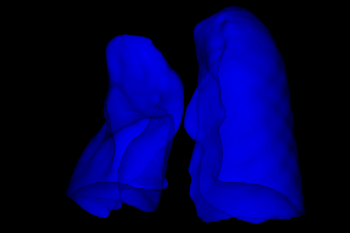 VTK: vtkImageData 转 vtkPolyData_vtk imagedata 转polydata-CSDN博客