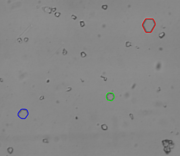 Halcon学习---案例实战(12)--动态阈值使用_selectgray-CSDN博客