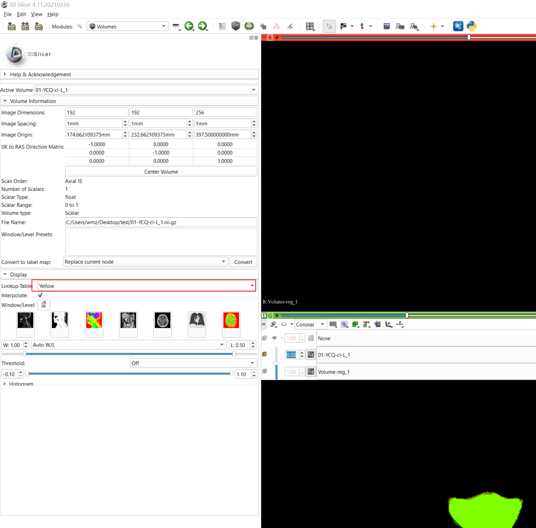 Slicer学习笔记（二十九）slicer指定标签颜色_3d slicer加载三维标签后如何调整标签颜色-CSDN博客