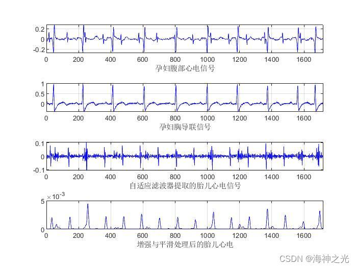 【心电信号ECG】基于matlab NLMS算法胎儿心电信号提取【含Matlab源码 3403期】_matlab lms算法 胎音信号-CSDN博客