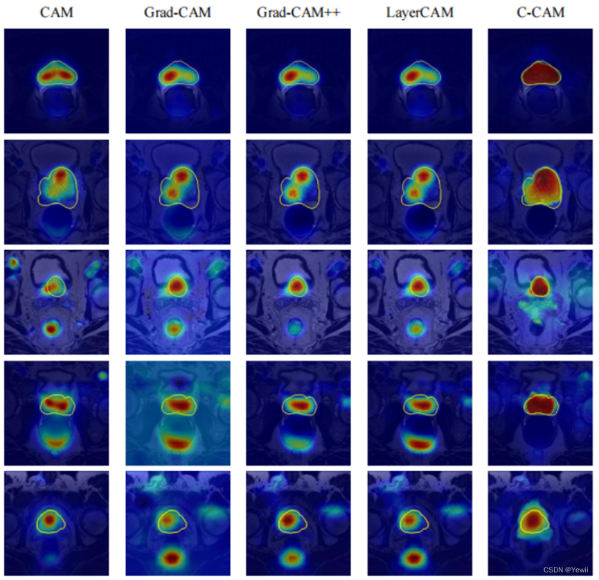 机翻《C-CAM: Causal CAM for Weakly Supervised Semantic Segmentation onMedical Image 》-CSDN博客