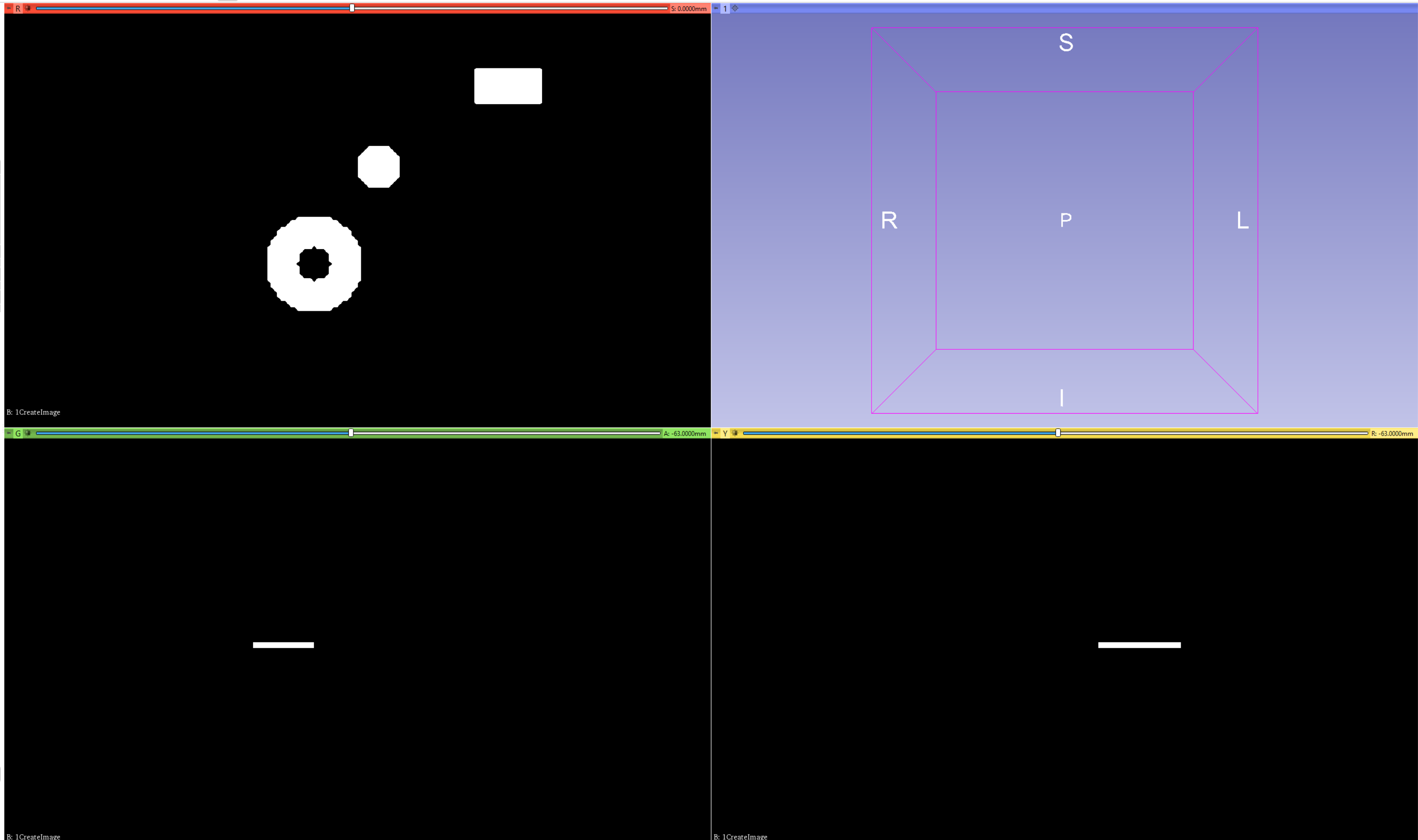 ITK学习笔记（二）最大圆度连通域提取_simpleitk oriented-CSDN博客