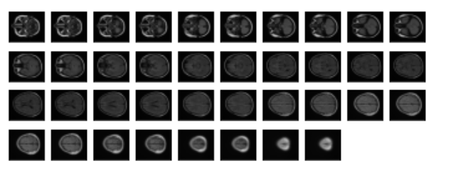 dicom转nii时，解决切片顺序保存混乱的问题_nii转 dicom后成不了序列-CSDN博客