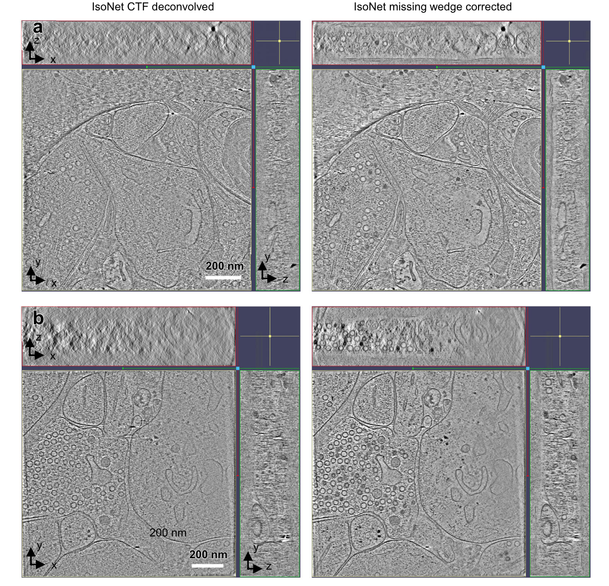【论文阅读|cryoET】Isotropic reconstruction for electrontomography with deep learning (解决缺失楔问题&降噪）_ctf ...