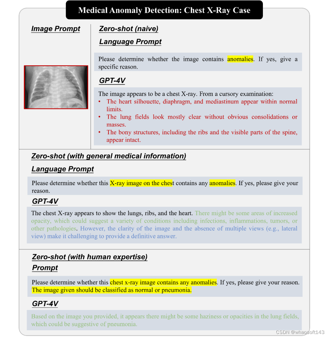 GPT4V-for-Generic-Anomaly-Detection-CSDN博客
