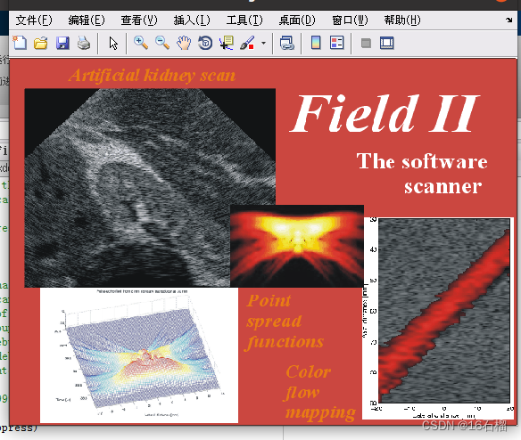 Filed II仿真软件的命令意义及如何实现超声平面波的仿真_超声仿真软件-CSDN博客