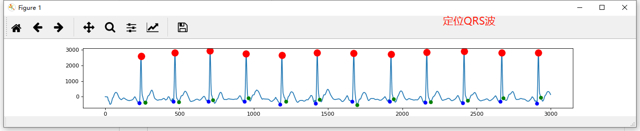 ECG信号滤波及计算心率_ecg滤波-CSDN博客
