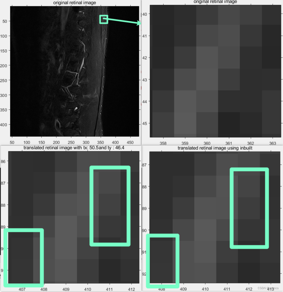 ＜Matlab医学图像处理(2)＞几何变换-CSDN博客