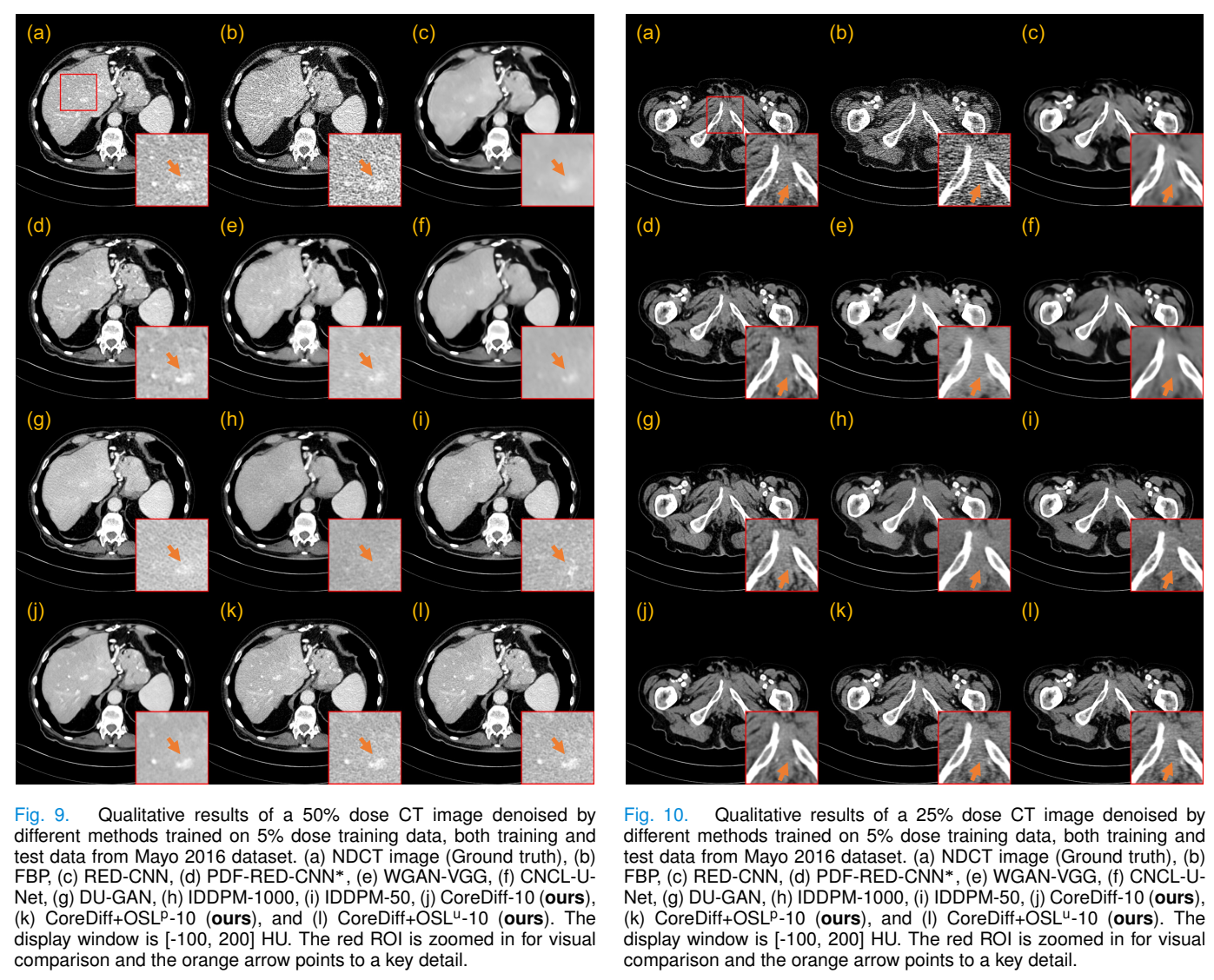 Contextual Error-Modulated Generalized Diffusion Model for Low-Dose CT Denoising and ...
