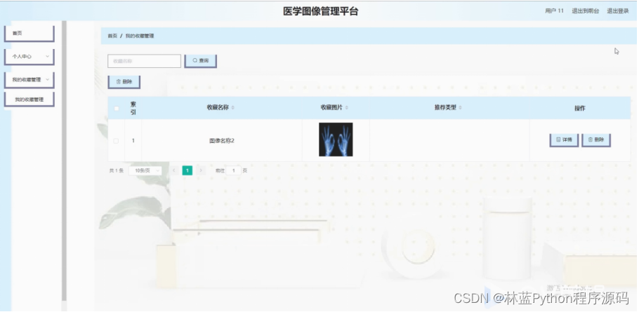 附源码 Python计算机毕业设计django医学图像管理平台django图片管理系统源代码免费 Csdn博客 