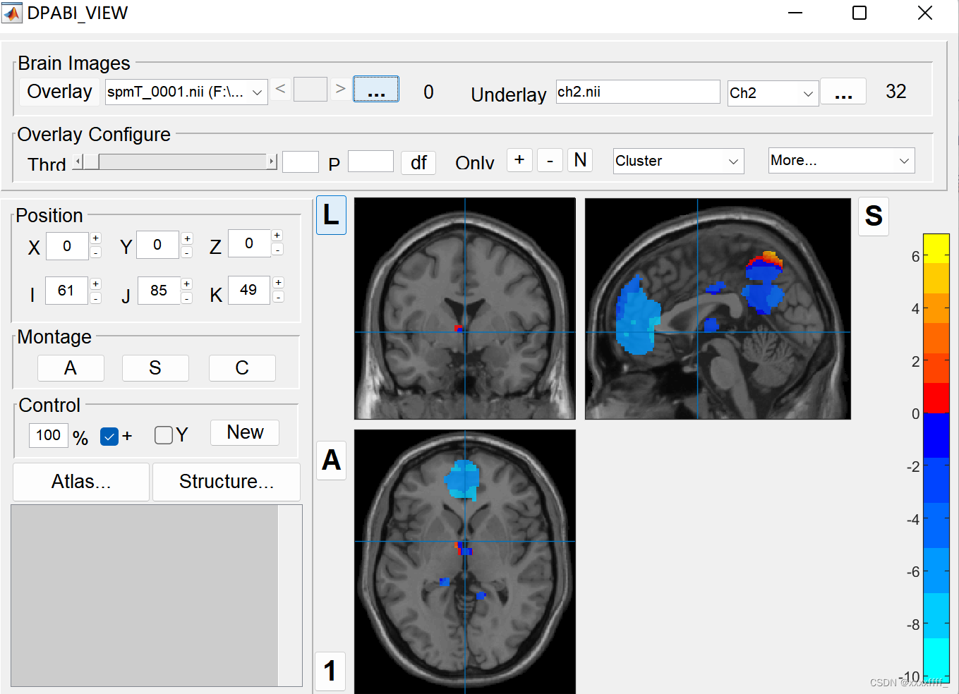 dpabi viewer使用-CSDN博客
