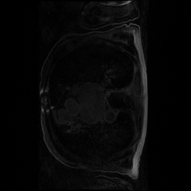 医学影像中用 python 读取 nrrd 文件、nrrd转nii、nrrd转h5_python 查看nrrd文件数据类型-CSDN博客
