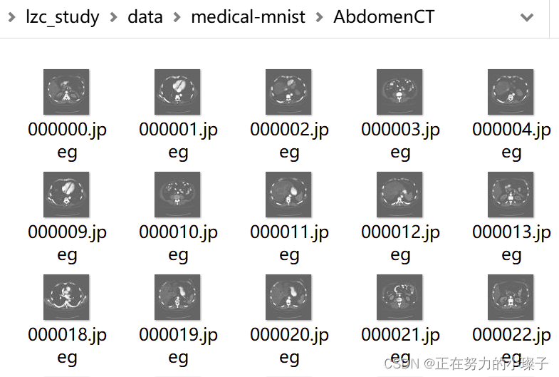 SKLearn实现SVM，使用medical-mnist数据集_medical mnist-CSDN博客
