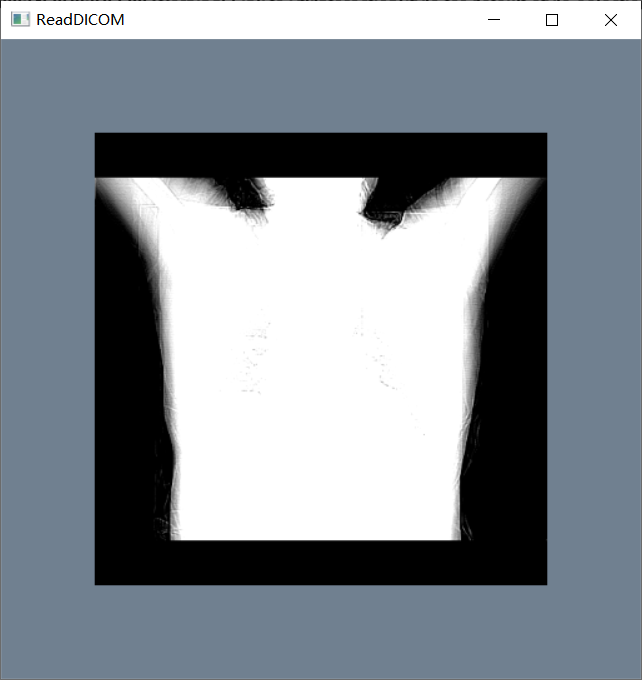 Vtk (1) _ read DICOM image - Programmer Sought