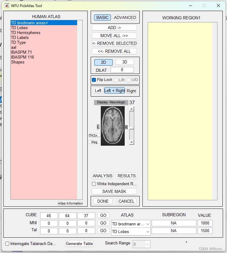 制作指定脑区的maks(包括重采样)_wfu pickatlas-CSDN博客