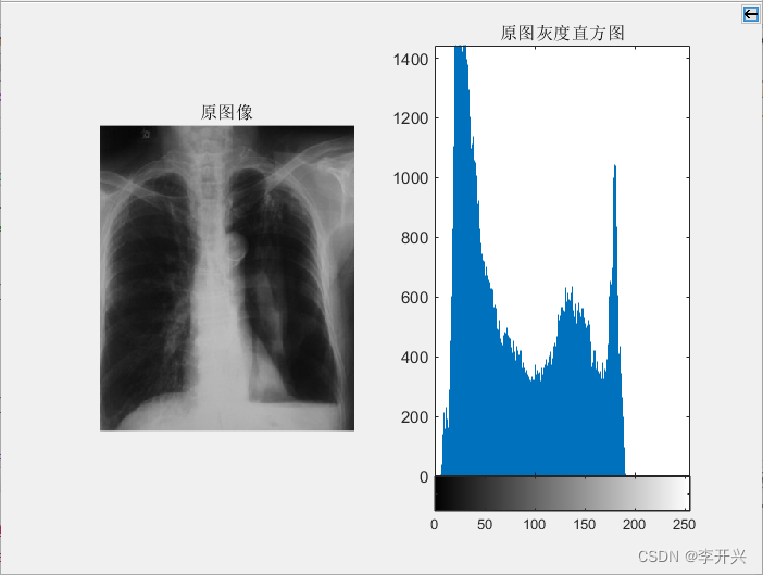 医学图像增强系统的设计_kaic_medical image enhancement-CSDN博客