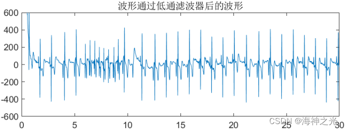 【心电信号 】ECG心电信号QRS波群特征提取【含Matlab源码 3385期】_差分法提取qrs波-CSDN博客