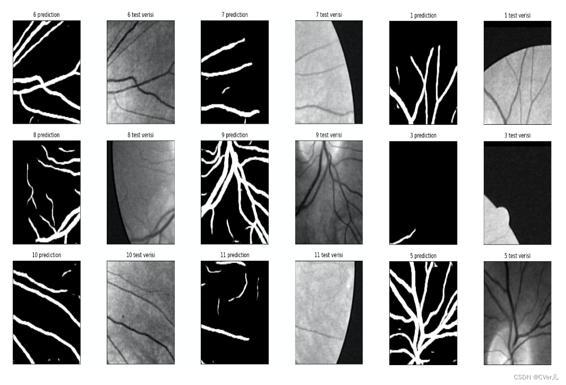 Unet U2net Multiresunet For Vessel Segmentation视网膜血管分割vesselseg Unet Csdn博客