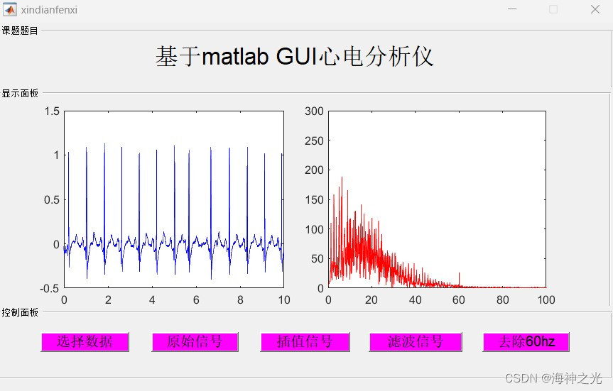 【心电信号】基于matlab GUI心电信号分析【含Matlab源码 2627期】_matlab gui 信号分析-CSDN博客