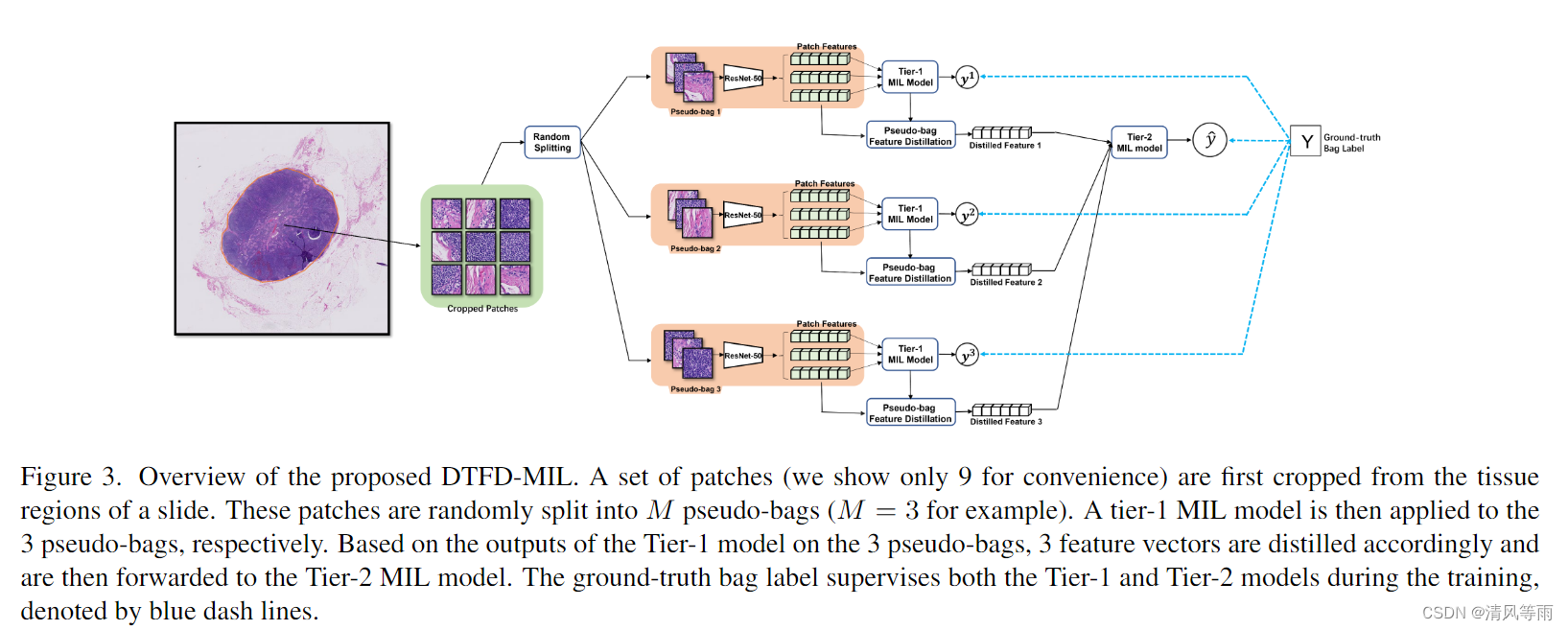 [论文阅读] 用于组织病理学全幻灯片图像分类的双层特征蒸馏多实例学习(DTFD-MIL)_dtfd::csdn-CSDN博客