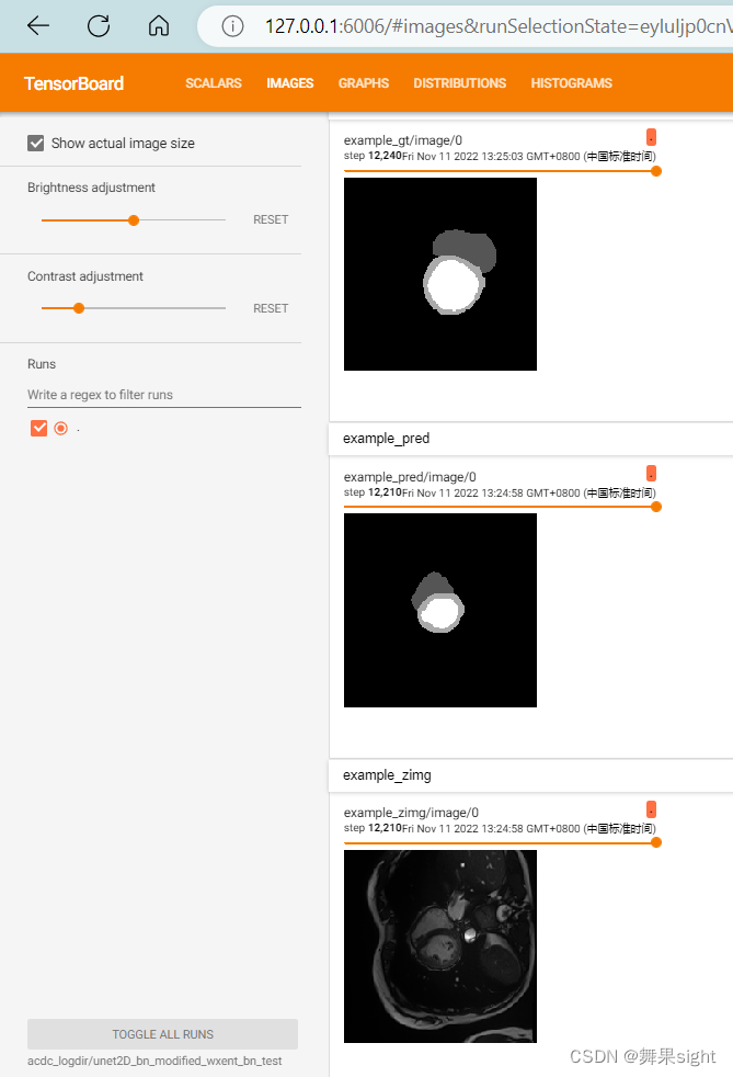 深度学习+心脏医学图像分割——自动心脏诊断挑战赛（ACDC）项目的代码学习记录_acdc挑战赛-CSDN博客