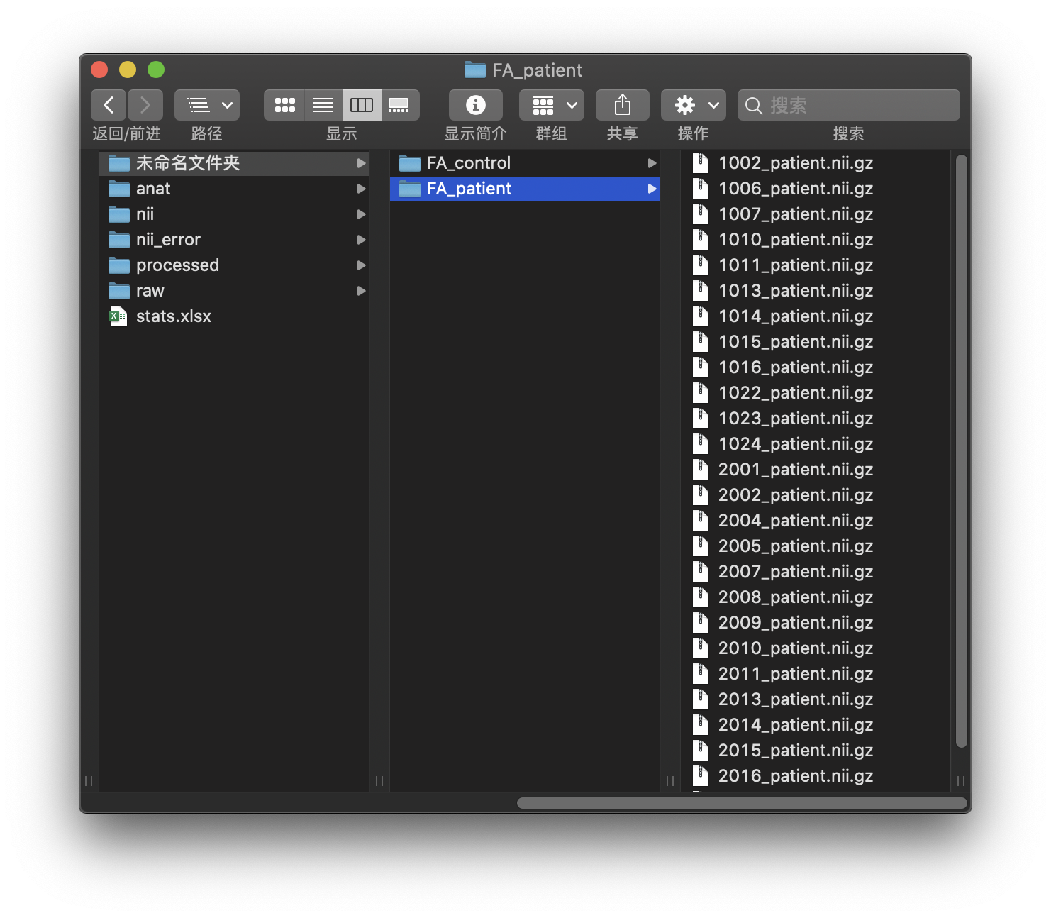 脑磁共振图像处理：SIM，DTIFIT，TBSS，FBA小记-CSDN博客