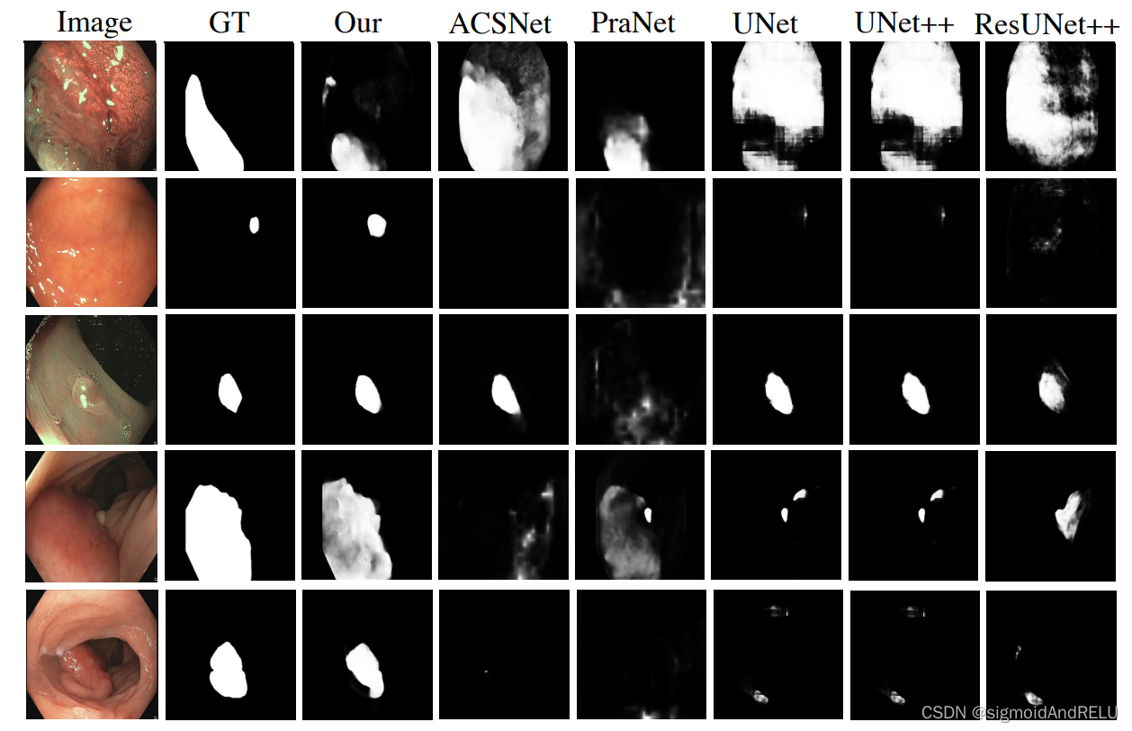 论文阅读：Duplex Contextual Relation Network for Polyp Segmentation-CSDN博客