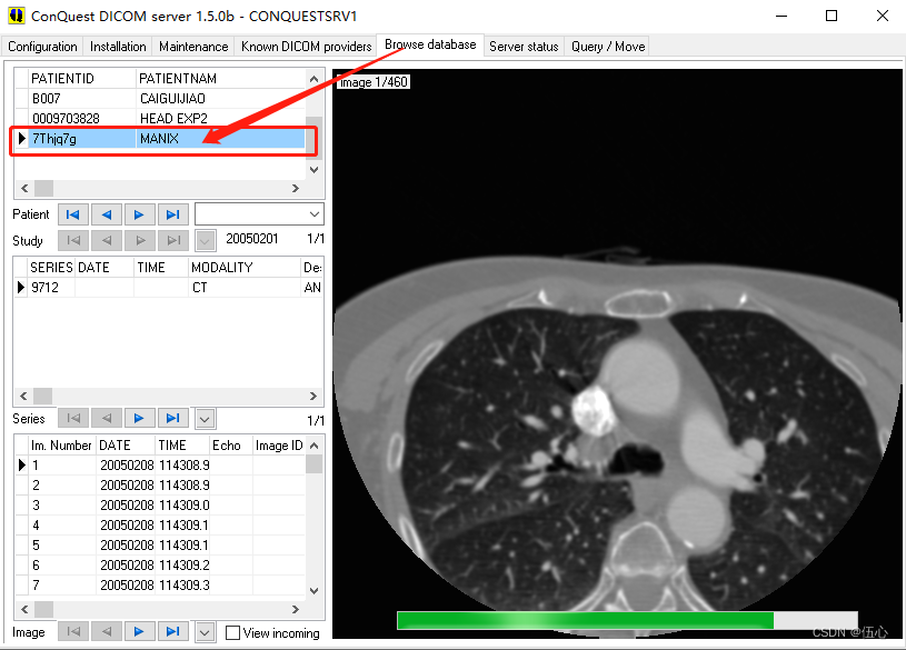 DCMTK findscu 查询信息-CSDN博客