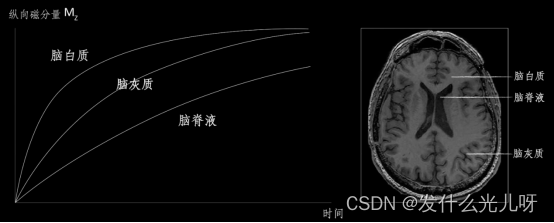 B站【老奇】核磁共振为何知道 笔记整理 MRI基础入门原理 sMRI 傅里叶变换_磁共振傅里叶变换的原理-CSDN博客