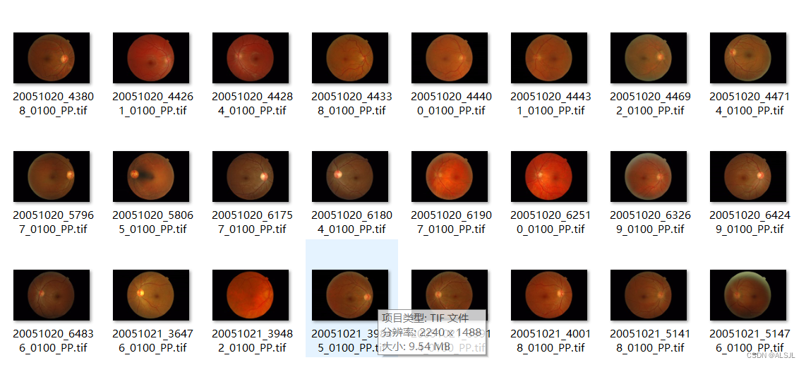 常用眼底图像数据集简介及下载--糖尿病视网膜病变 EyePacs,APTOS2019,STARE数据集-CSDN博客